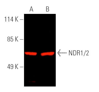 NDR1/2 Antibody (E-2) | SCBT - Santa Cruz Biotechnology
