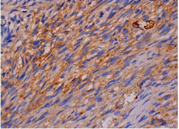 Anti-NDST Antibody (E-9) | SCBT - Santa Cruz Biotechnology