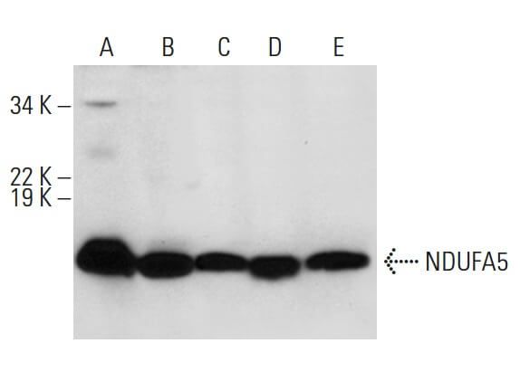 NDUFA5抗体 (A-3) | SCBT - Santa Cruz Biotechnology