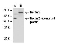 Nectin 2 Antibody (R2.525) | SCBT - Santa Cruz Biotechnology