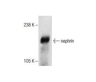 nephrin Antibody (G-8) - Western Blotting - Image 287857