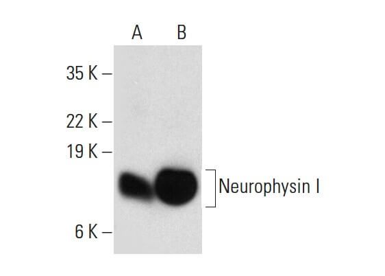 Neurophysin I Antibody (M-15) | SCBT - Santa Cruz Biotechnology