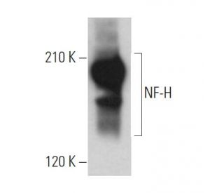 NF-H Antibody (RNF402) - Western Blotting - Image 362286