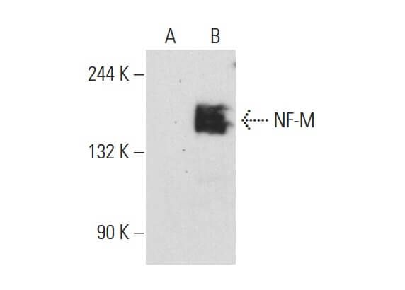 NF-M抗体 (NF-09) | SCBT - Santa Cruz Biotechnology