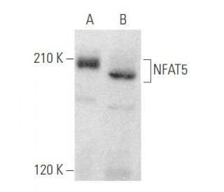 NFAT5 Antibody (F-9) | SCBT - Santa Cruz Biotechnology