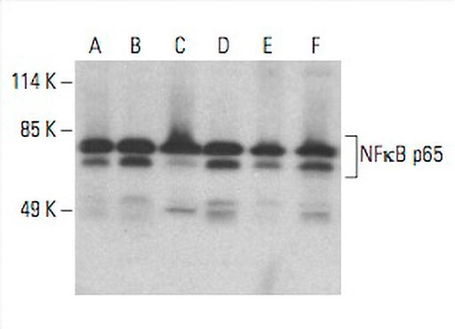 Anti-NFκB p65 Antibody (A-12) | SCBT - Santa Cruz Biotechnology