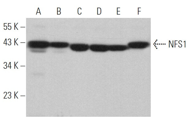 NFS1 Antibody (B-7) | SCBT - Santa Cruz Biotechnology