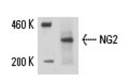 NG2抗体 (LHM 2) | SCBT - Santa Cruz Biotechnology