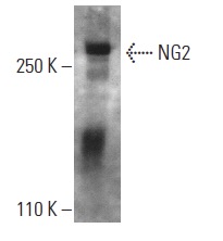 Anti-NG2 Antibody (LHM 2) | SCBT - Santa Cruz Biotechnology