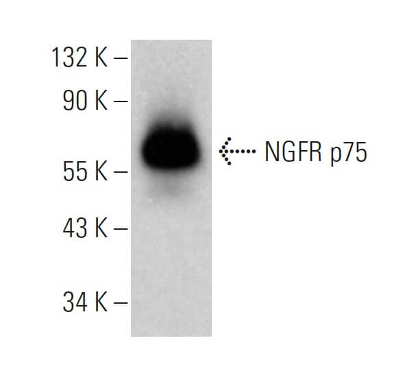NGFR p75 Antibody (NGFR5) | SCBT - Santa Cruz Biotechnology
