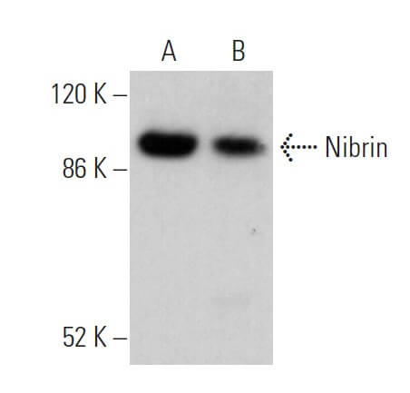 Anti-Nibrin Antibody (B-5) | SCBT - Santa Cruz Biotechnology