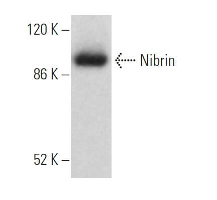 Anti-Nibrin Antibody (B-5) | SCBT - Santa Cruz Biotechnology