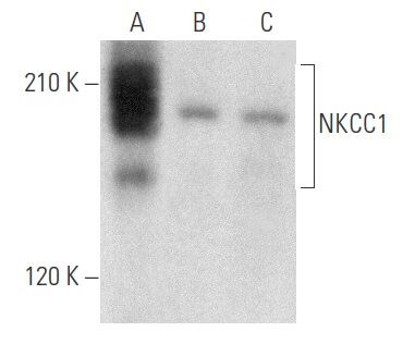 NKCC1 Antibody (A-6) | SCBT - Santa Cruz Biotechnology