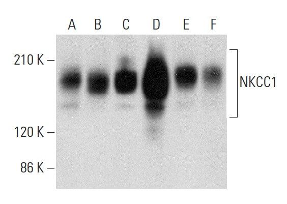NKCC1抗体 (N-16) | SCBT - Santa Cruz Biotechnology