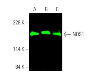 NOS1 Antibody (R-20) | SCBT - Santa Cruz Biotechnology