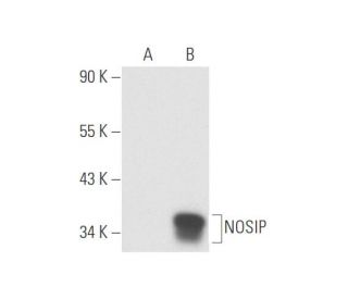 NOSIP Antibody (G-6) | SCBT - Santa Cruz Biotechnology