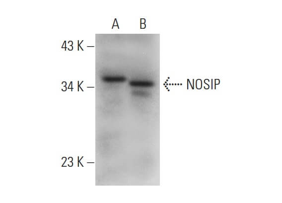 NOSIP Antibody (G-6) | SCBT - Santa Cruz Biotechnology