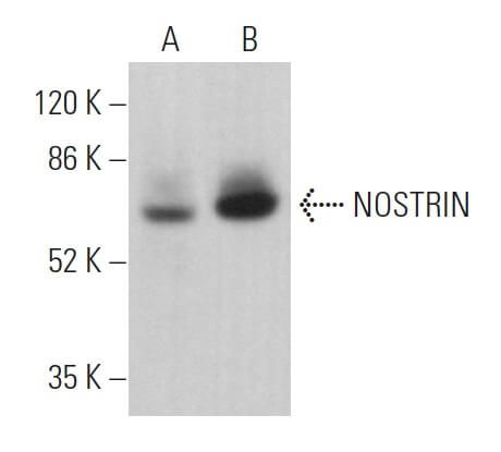 NOSTRIN Antibody (F-10) | SCBT - Santa Cruz Biotechnology