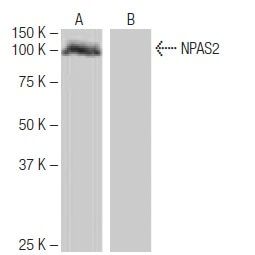 NPAS2抗体 (FT-68) | SCBT - Santa Cruz Biotechnology