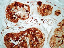 Anti-NQO1 Antibody (A180) | SCBT - Santa Cruz Biotechnology