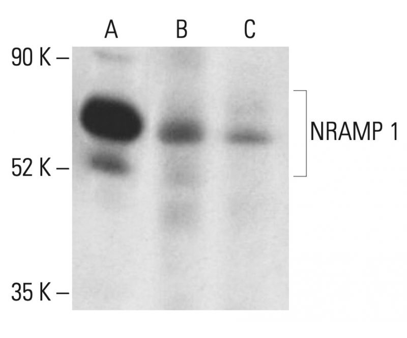 NRAMP 1 Antibody (E-2) | SCBT - Santa Cruz Biotechnology