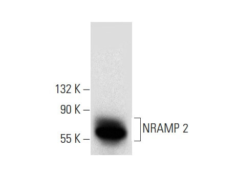 Anti-NRAMP 2 Antibody (G-5) | SCBT - Santa Cruz Biotechnology