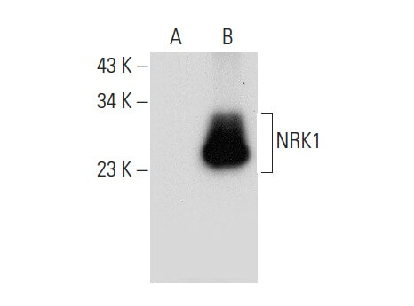 Anti-NRK1 Antibody (F-8) | SCBT - Santa Cruz Biotechnology