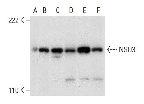 NSD3 Antibody (E-3) | SCBT - Santa Cruz Biotechnology