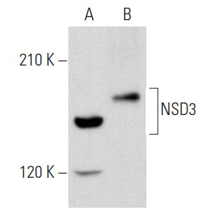 NSD3 Antibody (E-3) | SCBT - Santa Cruz Biotechnology
