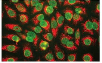 Nuclear Envelope and Nuclear Pore Marker Antibody (39C7) | SCBT - Santa ...