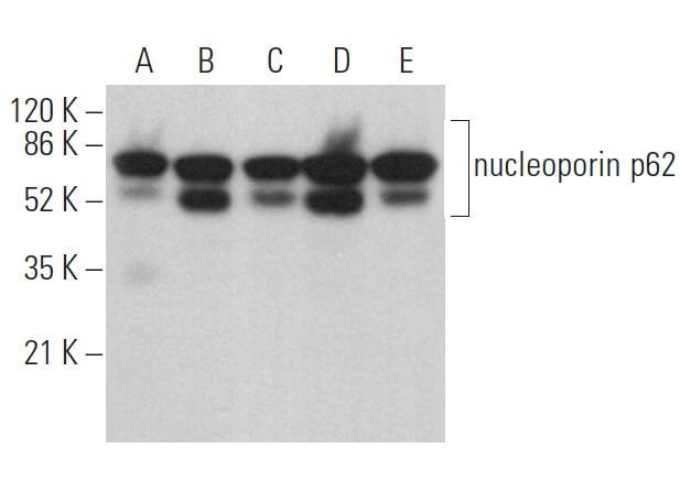 nucleoporin p62 Antibody (2A11) | SCBT - Santa Cruz Biotechnology