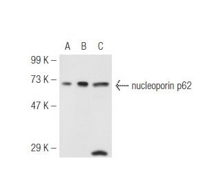 nucleoporin p62 Antibody (E-4) | SCBT - Santa Cruz Biotechnology