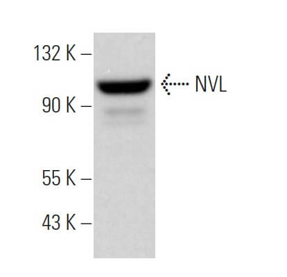 NVL Antibody (A-10) | SCBT - Santa Cruz Biotechnology