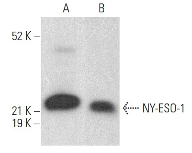 Anti-NY-ESO-1 Antibody (E978) | SCBT - Santa Cruz Biotechnology