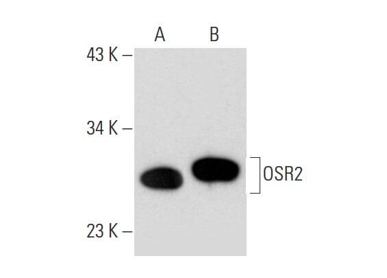 OSR2抗体 (H-8) | SCBT - Santa Cruz Biotechnology