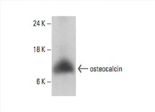 Anti-osteocalcin Antibody (C-7) | SCBT - Santa Cruz Biotechnology