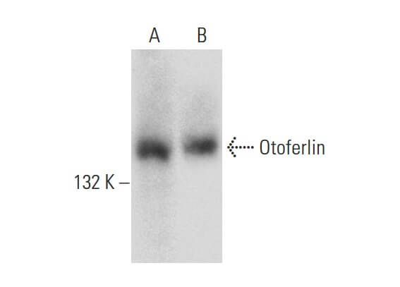 Otoferlin Antibody (C-12) | SCBT - Santa Cruz Biotechnology