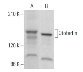 Otoferlin Antibody (C-12) - Western Blotting - Image 364691