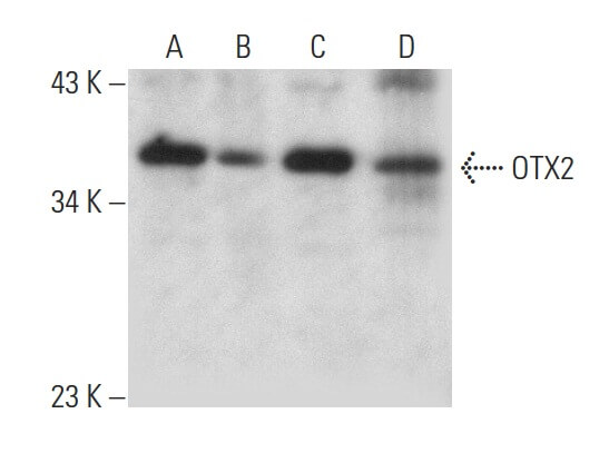 OTX2 Antibody (D-8) | SCBT - Santa Cruz Biotechnology