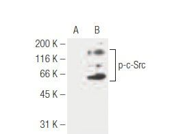 p-Src抗体 (9A6) | SCBT - Santa Cruz Biotechnology