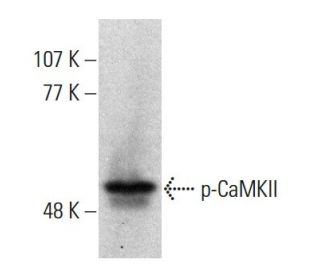 p-CaMKII Antibody (22B1) - Western Blotting - Image 364809