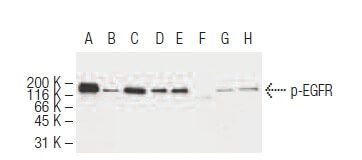 p-EGFR Antibody (10G12) | SCBT - Santa Cruz Biotechnology