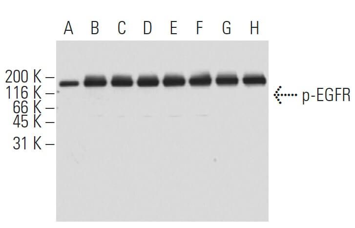 p-EGFR Anticuerpo (11C2) | SCBT - Santa Cruz Biotechnology