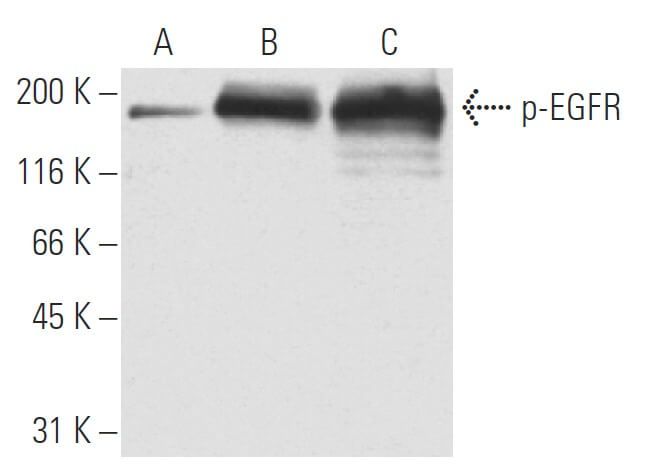 p-EGFR (Tyr 1173) Antibody (Tyr 1173) | SCBT - Santa Cruz Biotechnology