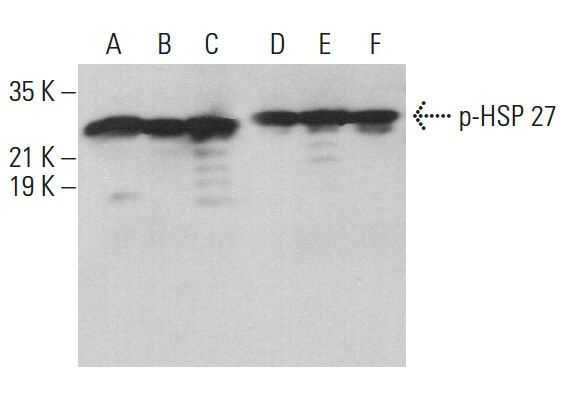 p-HSP 27 Antibody (B-3) | SCBT - Santa Cruz Biotechnology