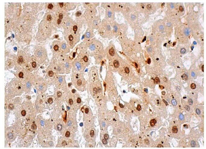 Anti-p-Met Antibody (F-5) | SCBT - Santa Cruz Biotechnology