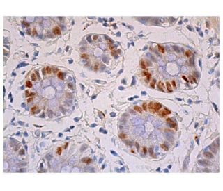 p-Met Antibody (Ser 985) | SCBT - Santa Cruz Biotechnology