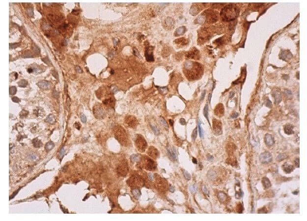p-mTOR Antibody (296.Ser 2481) | SCBT - Santa Cruz Biotechnology
