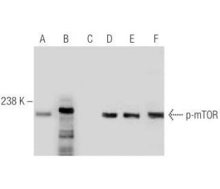 p-mTOR Antibody (59.Ser 2448) - Western Blotting - Image 164506