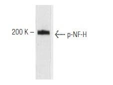 p-NF-H Antibody (NAP4) | SCBT - Santa Cruz Biotechnology